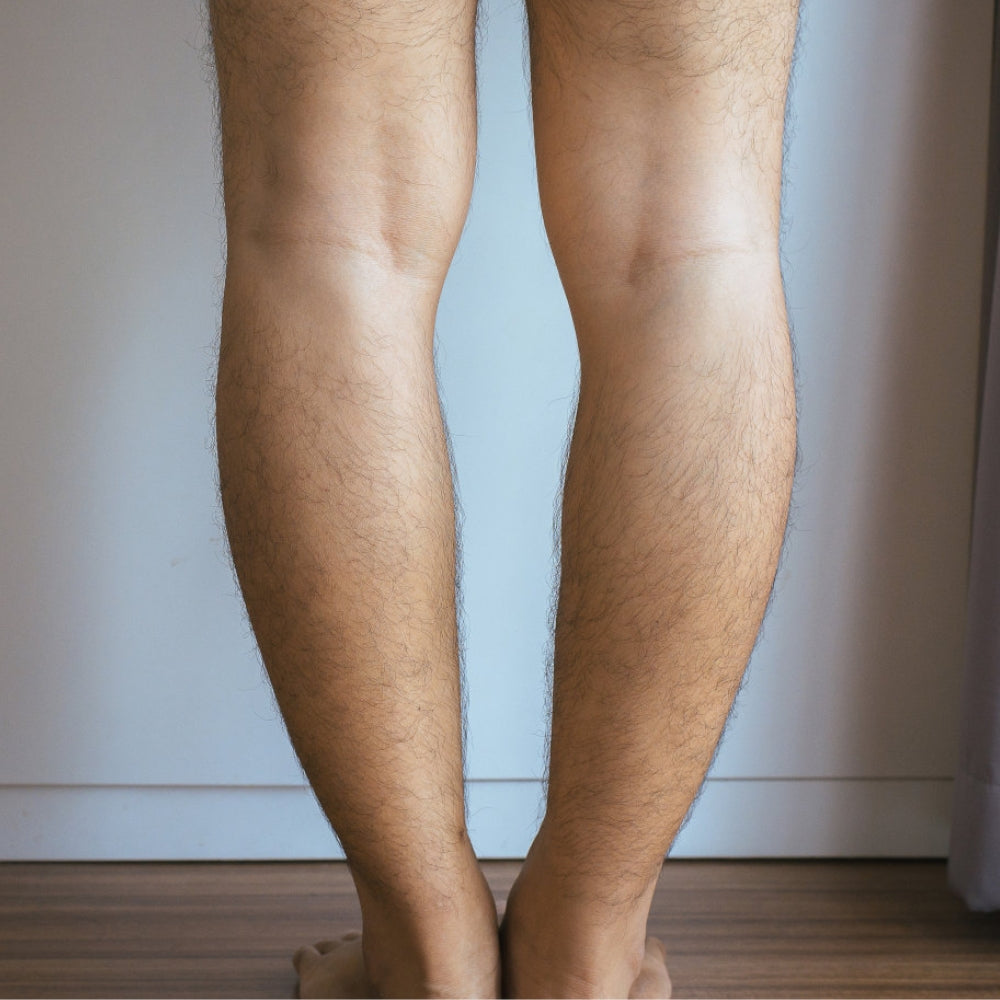 What to wear with bow feet? How to choose the right shoes